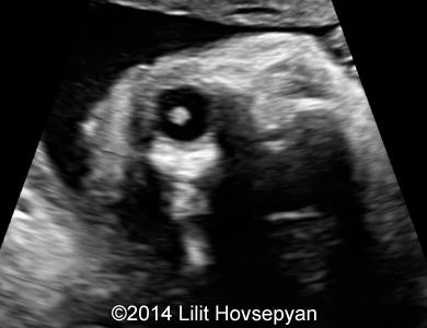 Case of the Week # 388