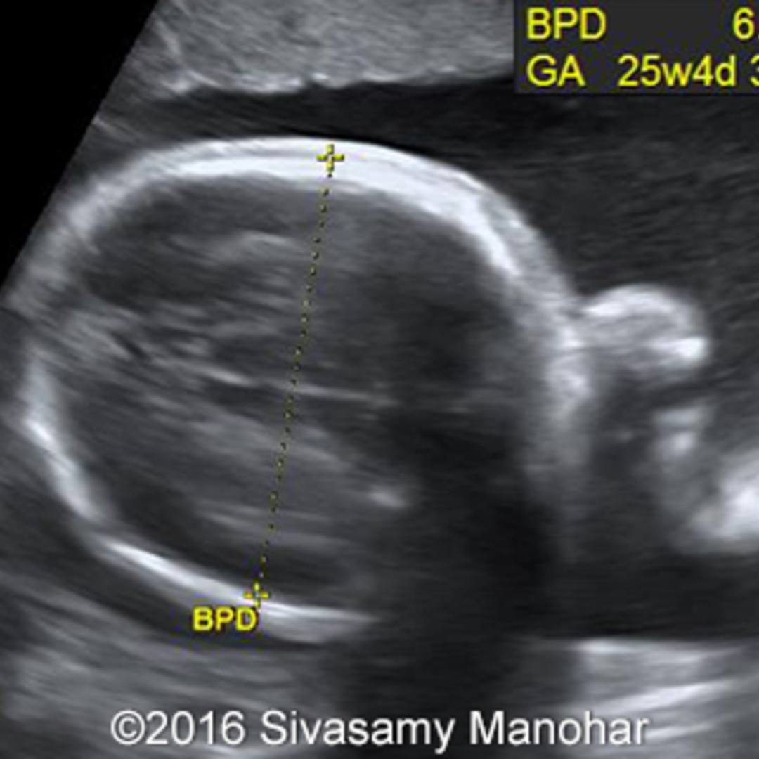 Case of the Week # 428