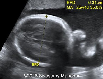 Case of the Week # 428