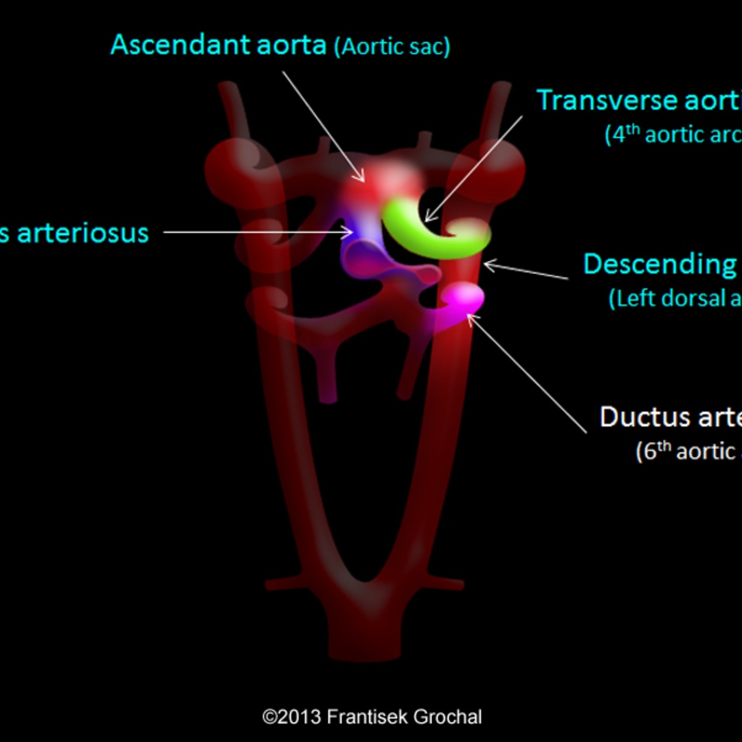 Transverse Arch Aorta