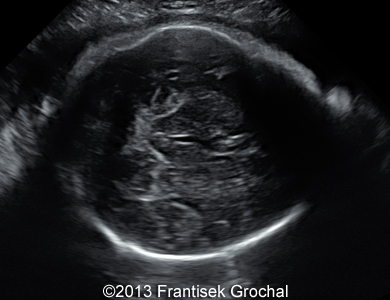 Case of the Week # 361