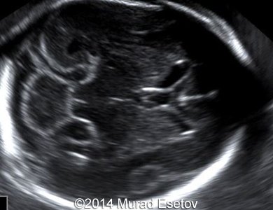 Case of the Week # 372