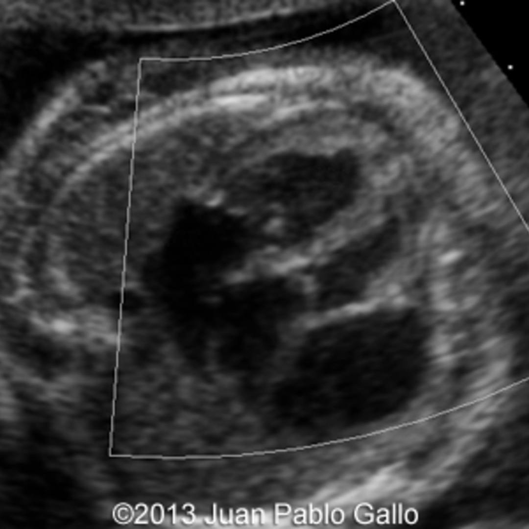 Case of the Week # 358