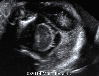 Case of the Week # 372