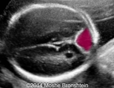 Case of the Week # 371