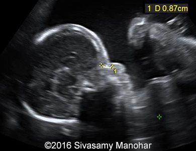 Case of the Week # 428