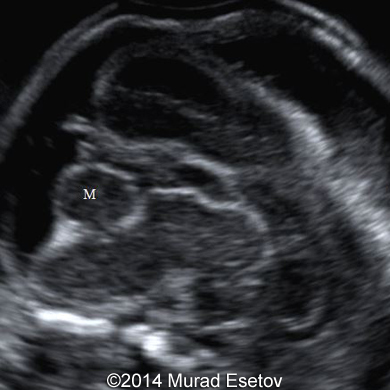 Case of the Week # 372