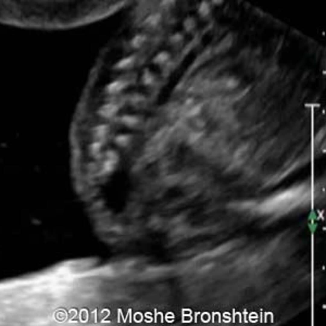 Case of the Week # 316