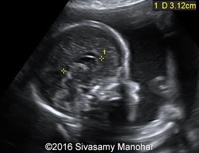 Case of the Week # 428