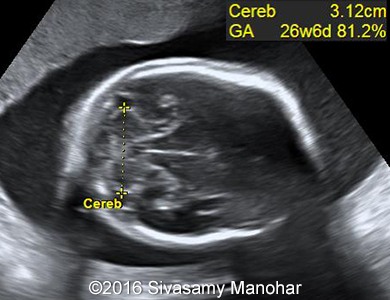 Case of the Week # 428