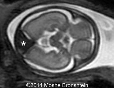 Case of the Week # 371