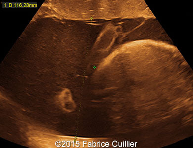 Case of the Week # 395