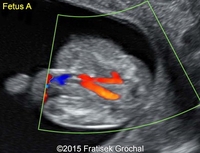 Case of the Week # 397
