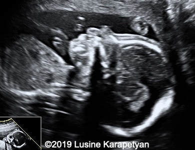 Case of the Week # 496