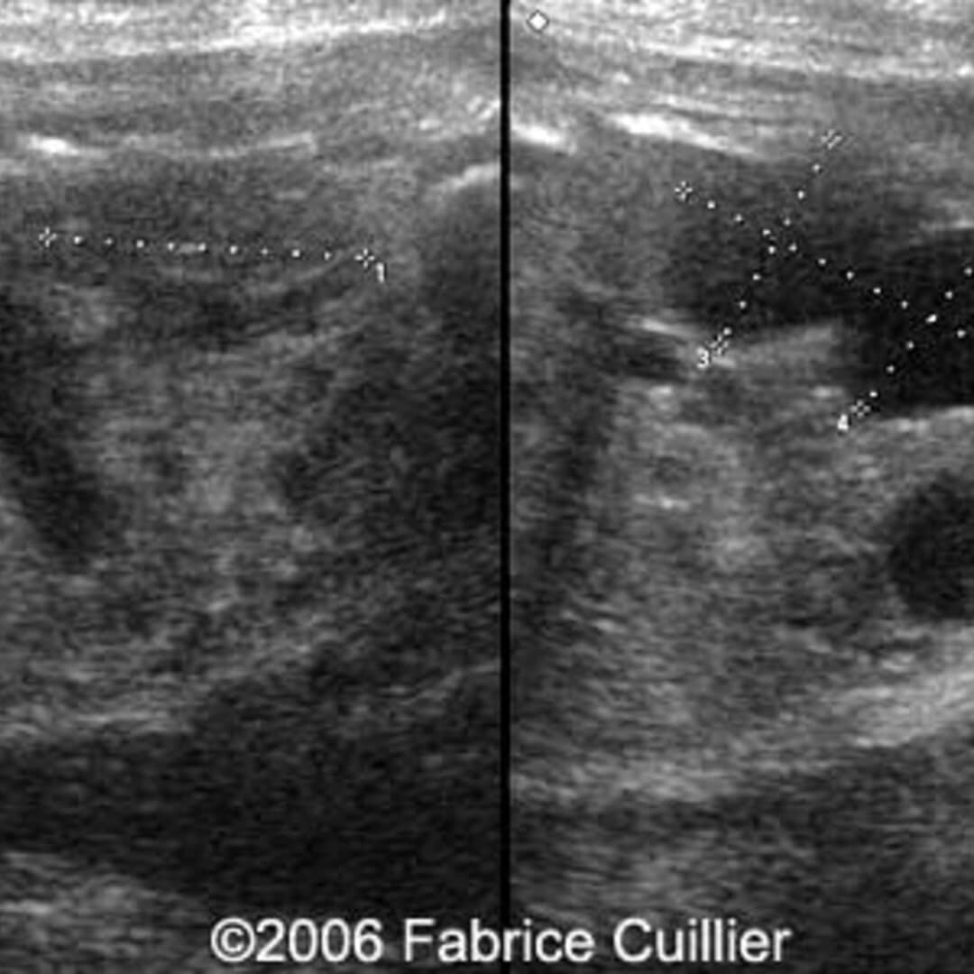 Case of the Week # 177