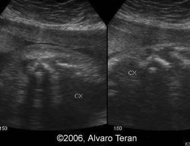 Case of the Week # 183