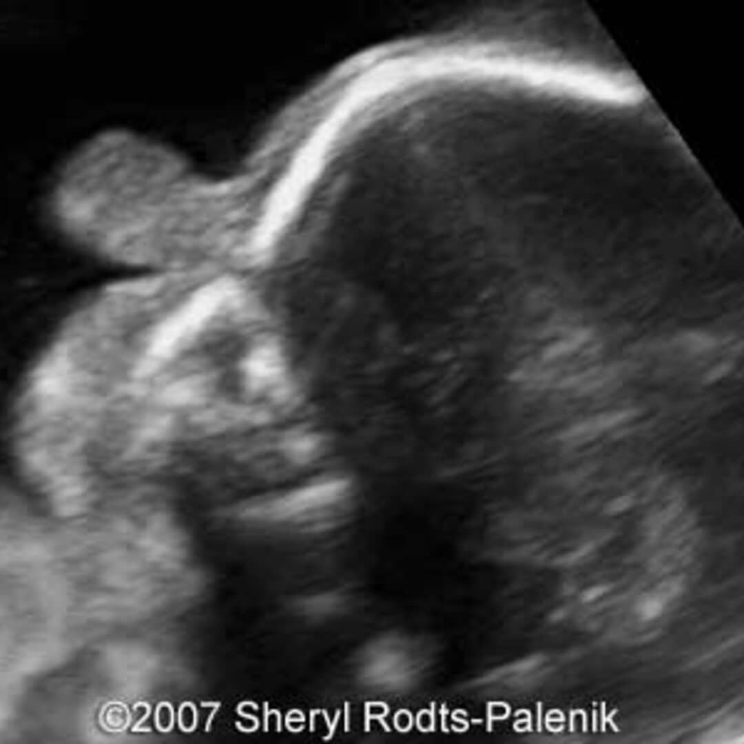 Case of the Week # 200