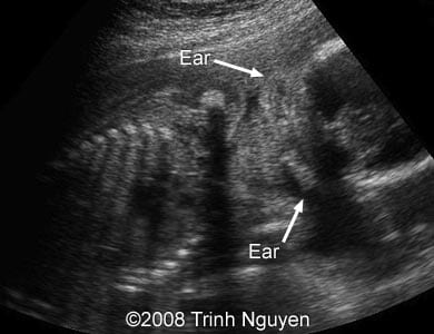 Case of the Week # 222