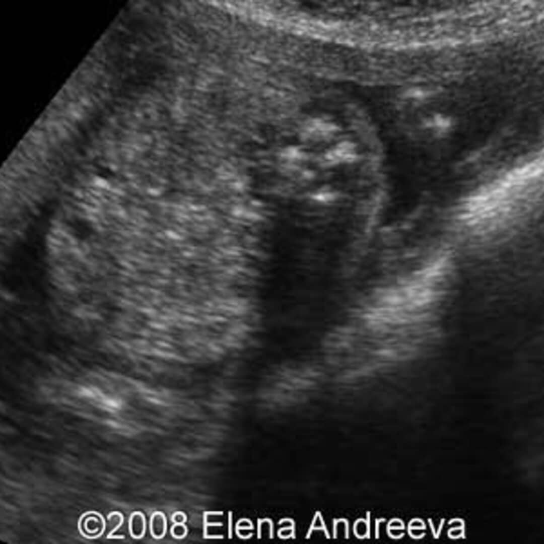 Case of the Week # 223