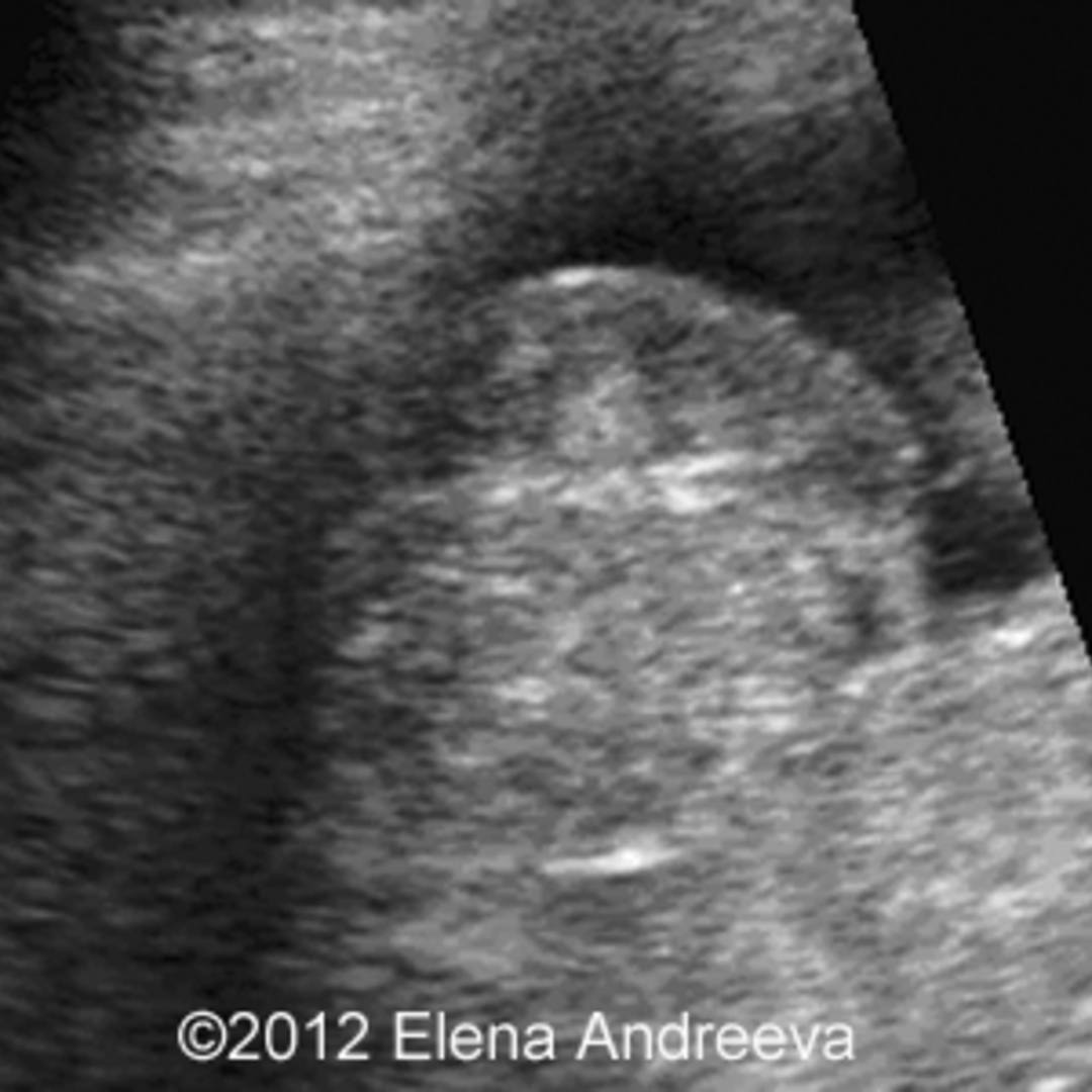 Case of the Week # 344