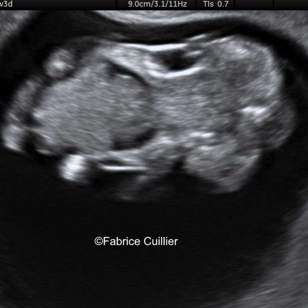 Case of the Week #533