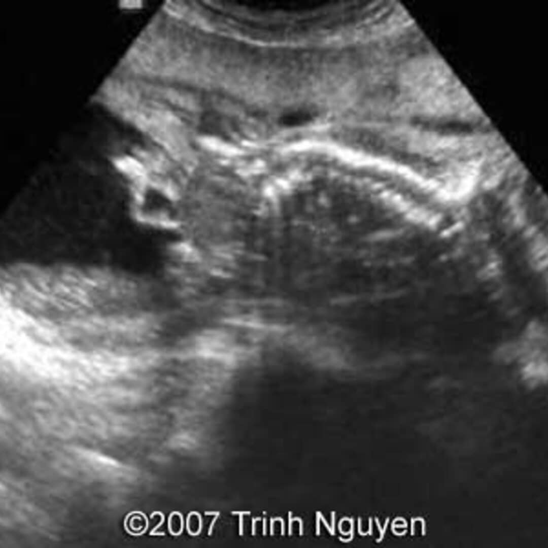 Case of the Week # 204