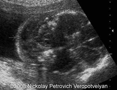 Case of the Week # 237