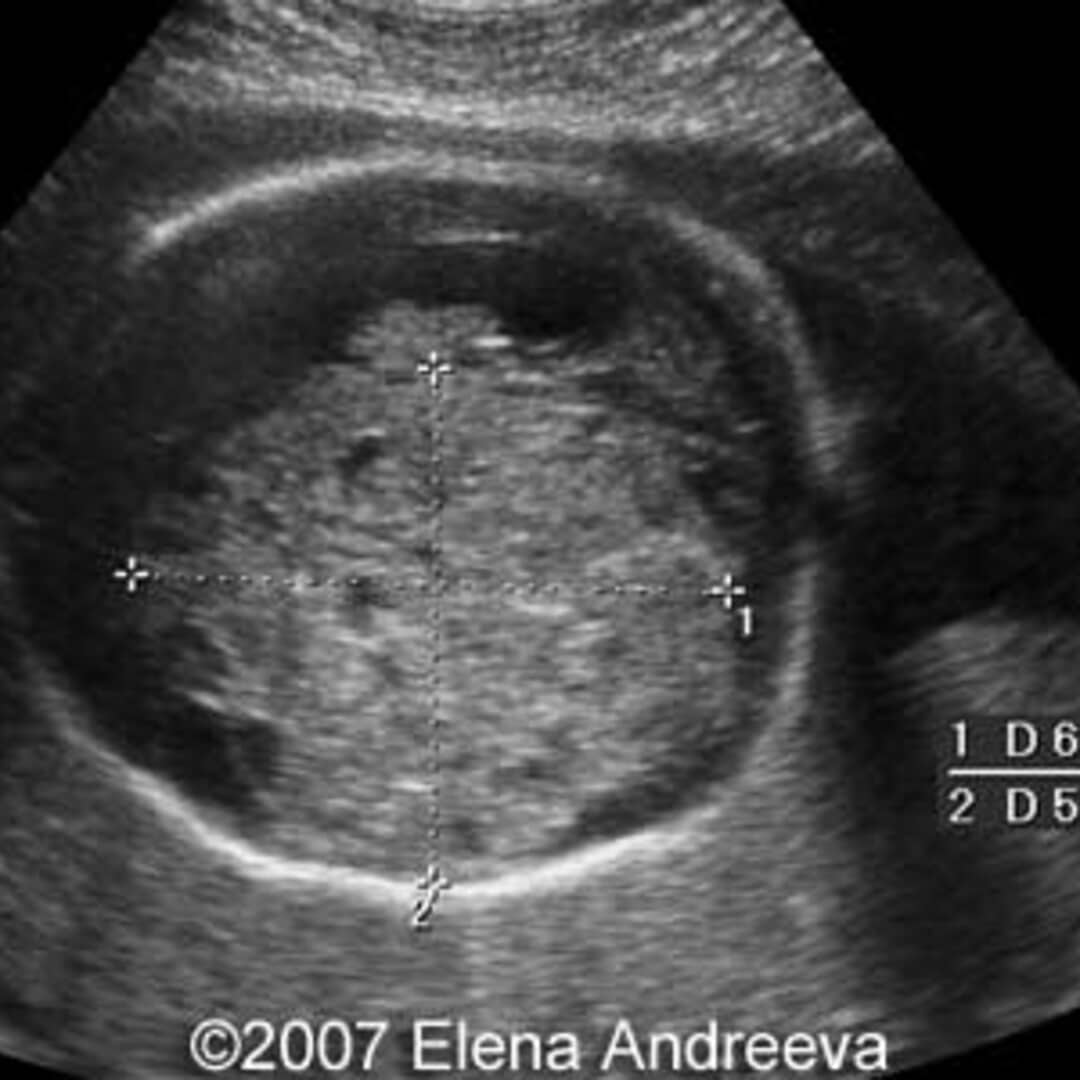 Case of the Week # 206