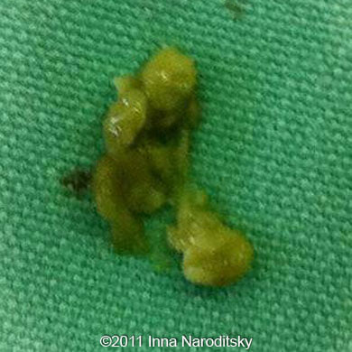 Case of the Week # 312