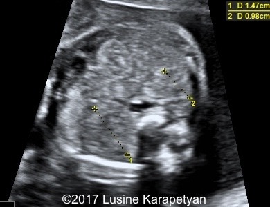 Case of the Week # 460