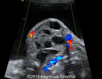 Case of the Week # 310