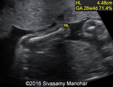 Case of the Week # 428