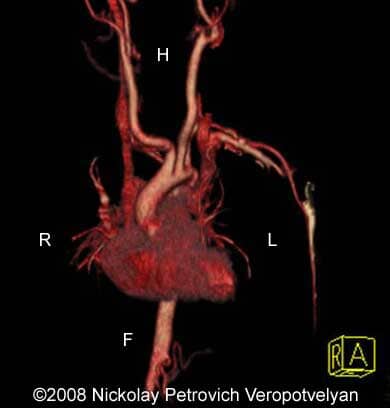 Case of the Week # 237