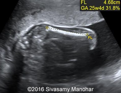 Case of the Week # 428