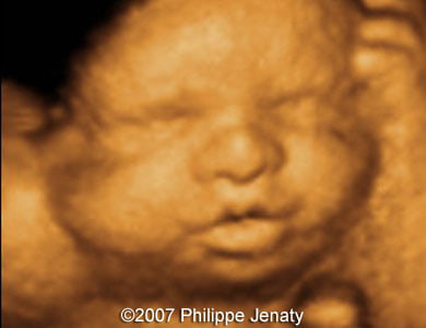 Case of the Week # 199