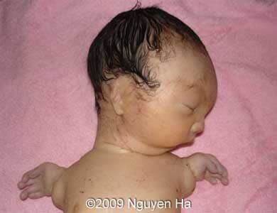 Case of the Week # 238