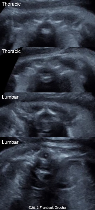 Case of the Week # 361