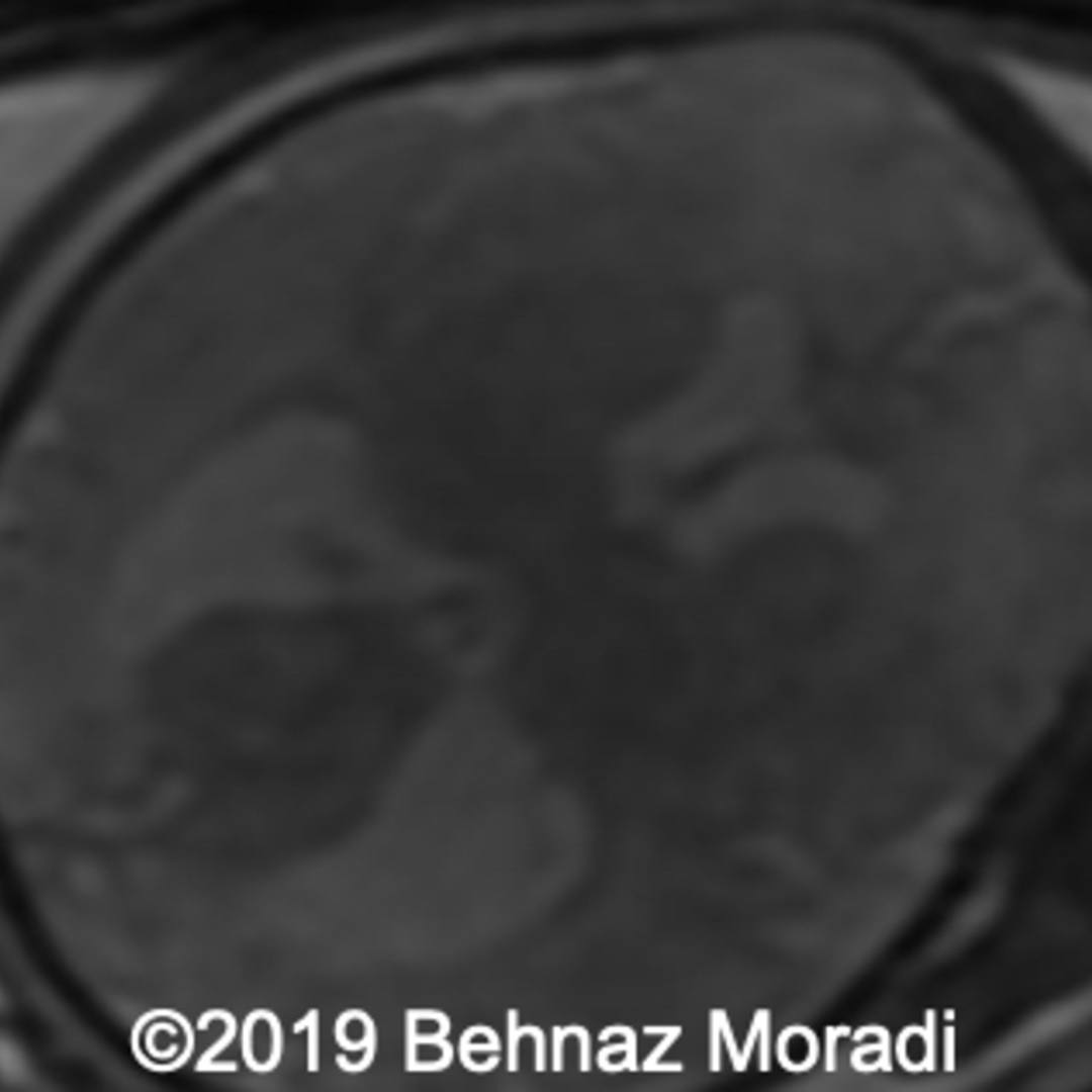 Case of the Week # 493