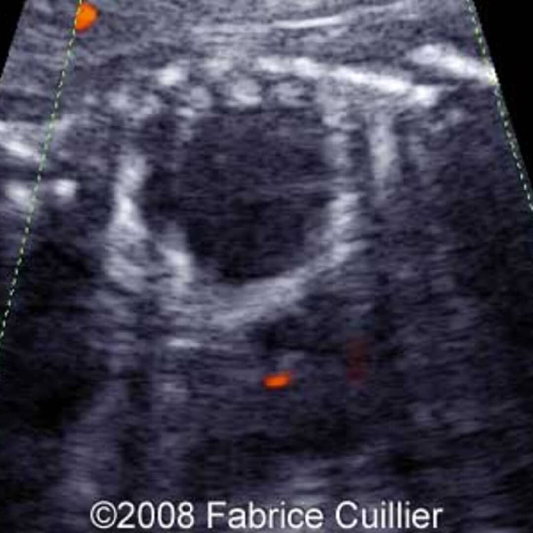 Case of the Week # 225