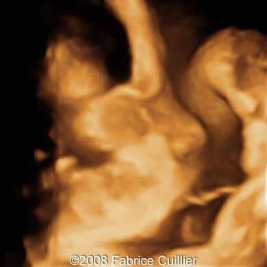 Case of the Week # 231