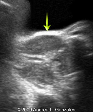 Case of the Week # 243