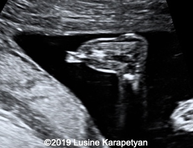 Case of the Week # 496