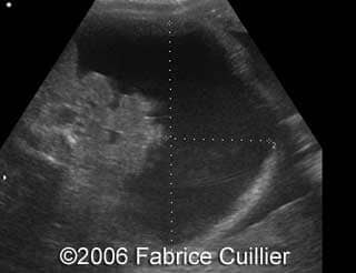 Case of the Week # 182