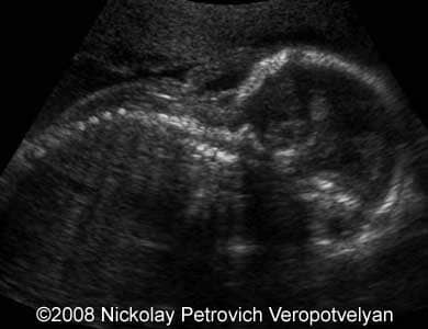 Case of the Week # 237