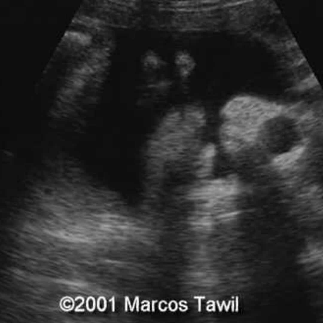 Case of the Week # 58