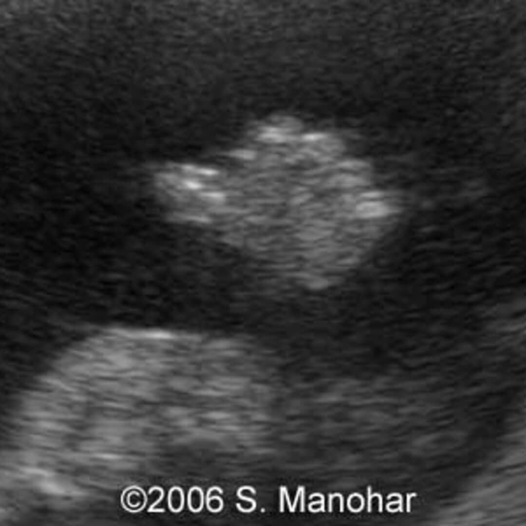 Case of the Week # 187