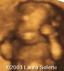 📃 The development of the fetal face through 3D imaging