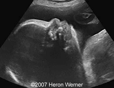 Case of the Week # 194