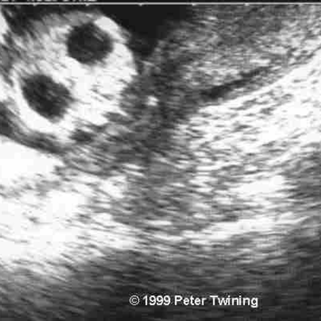 Case of the Week # 3