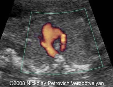 Case of the Week # 237